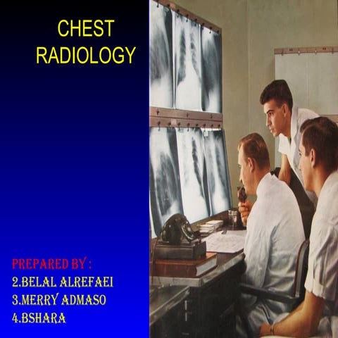 Chest xray | PPT