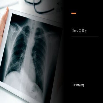 Normal Chest X-ray | PPTX