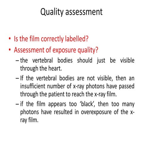 Chest x ray basic | PDF