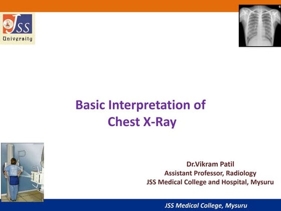 Chest x ray quality - how to interpret chest x-ray (1) | PPTX