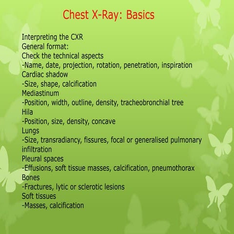 Chest x ray basics | PPTX