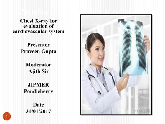 Chest X ray ( steps for interpretation) | PPTX | Lung and Respiratory ...