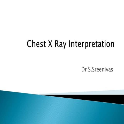 Chest X Ray Interpretation 1 Pptx By Srinivas Pptx