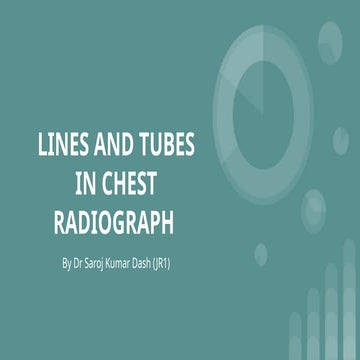 Lines and tubes in xray | PPTX