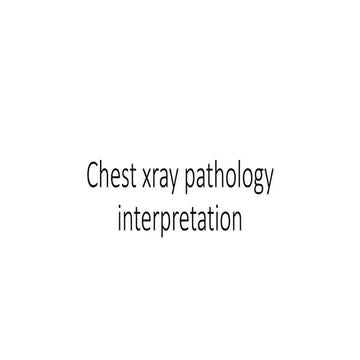 Chest xray pathologies interpretation.pptx | Lung and Respiratory ...