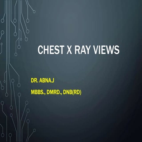 Upper limb radiography | PPTX