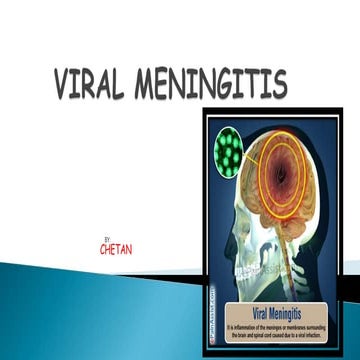 meningitis case presentation | PPTX