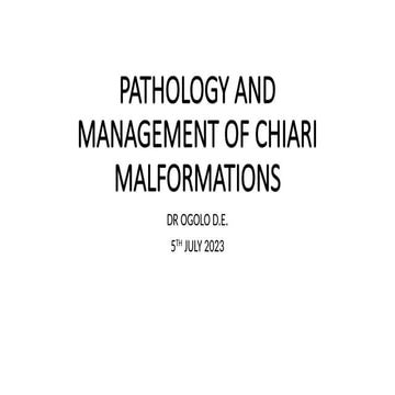 Chiari_Malformation_Enhanced types and clinical pictures and management ...