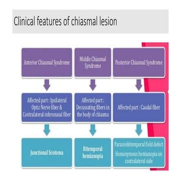 chiasmal syndrome.pptx | Eye and Vision Conditions | Diseases and ...