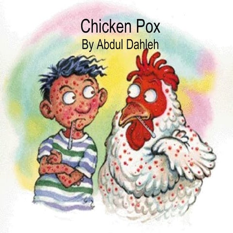 Chicken Pox | PPT