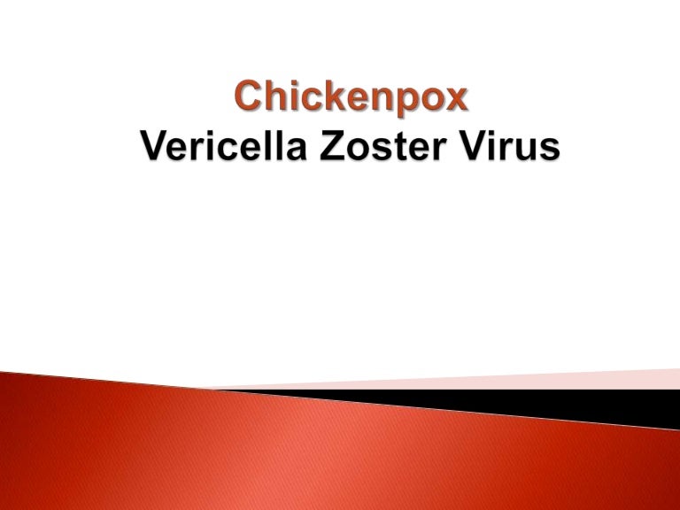Chickenpox Cks