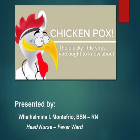 Chicken pox | PPTX