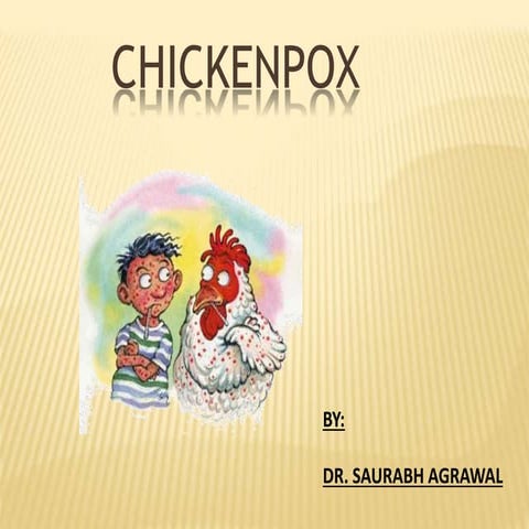 CHICKENPOX ppt | PPTX