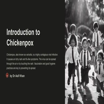 Epidemiology Prevention and control of chickenpox | PPTX