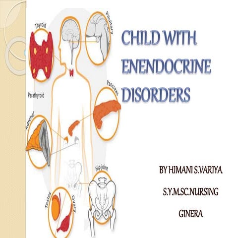 Child with enendocrine disorders | PPTX