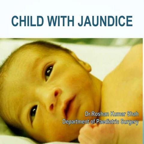 Child with jaundice | PPTX