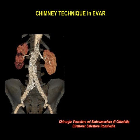 Chimney Technique in EVAR | PPT