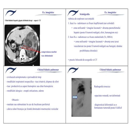 chist pulmonar.pdf