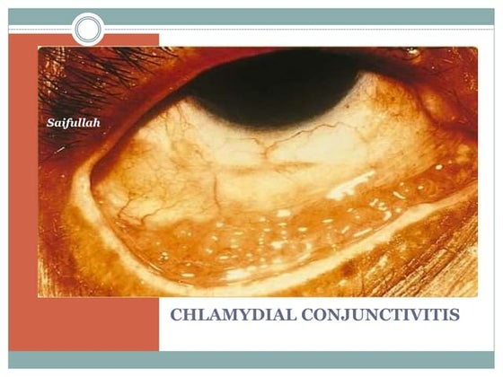 Chlamydia | PPT
