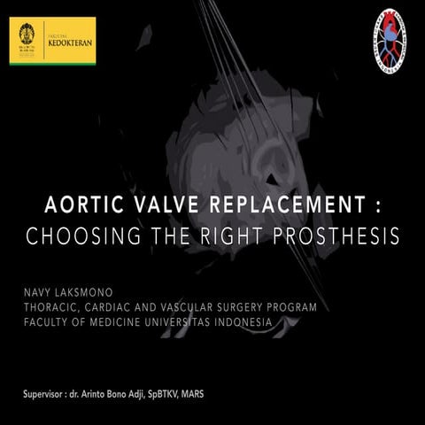 Choosing a prosthetic valves in aortic valve replacement surgery | PDF