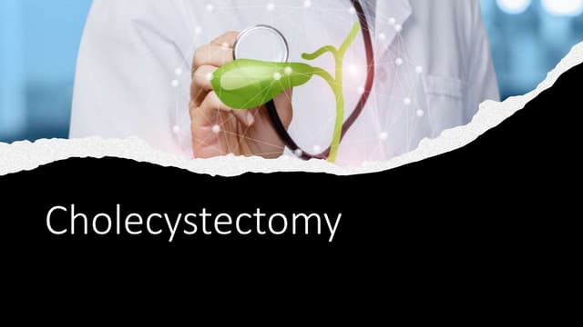 Cholecystectomy | PPTX