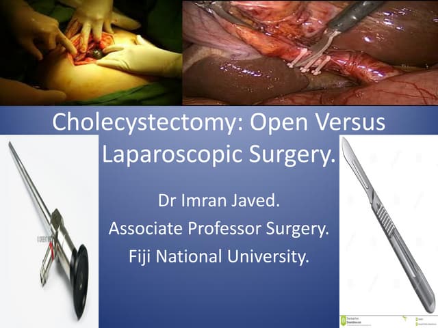 Cholecystectomy | PPTX