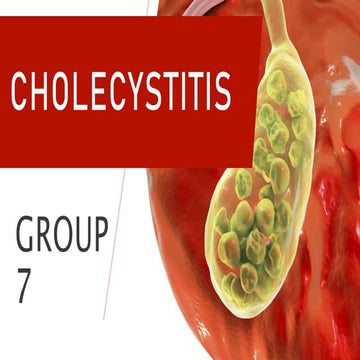 ACUTE CHOLECYSTITIS, INCIDENCE, PATHOPHYSIOLOGY, ETIOLOGY, RISKFACTORS.pptx