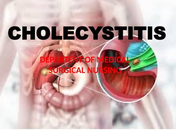 Acute cholecystitis.pdf