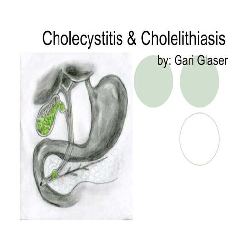 cholecystitis-cholelithiasis-presentation.ppt