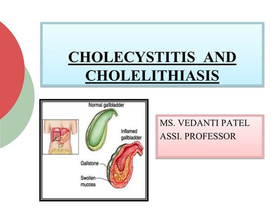 Pathophysiology of Cholecystitis and cholelithiasis | PPT