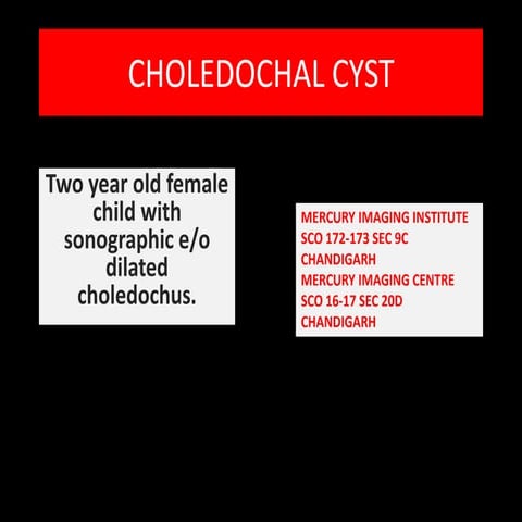 Choledochal cyst | PPTX | Digestive Disorders | Diseases and Conditions