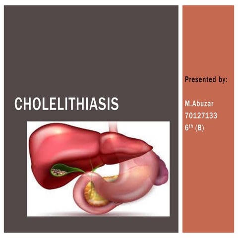 cholelithiasis power point presentation1 | PDF