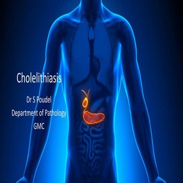 Cholelithiasis and cholecystitis.pptx 012 | PPTX