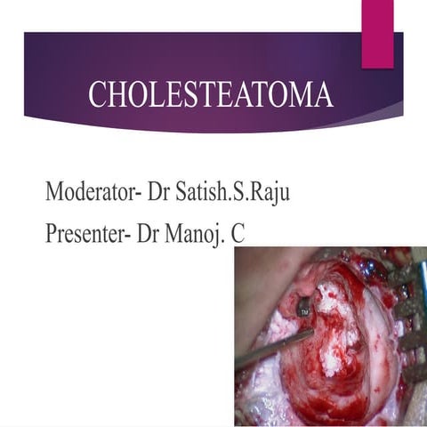This presentation has Cholesteatoma Management. | PPTX