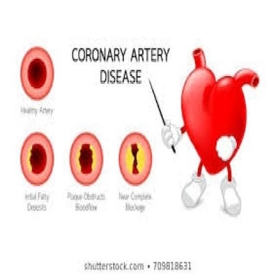 Cholesterol control easily | PDF