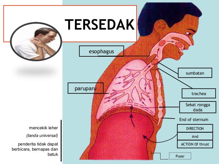Tersedak