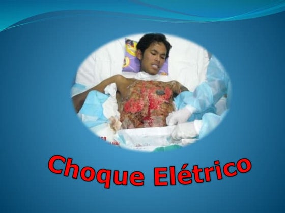 Primeiros socorros para choque elétrico | PDF