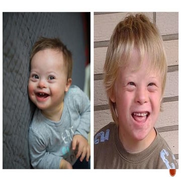 CHROMOSOMAL-ABERRATIONS-CHROMOSSAL ABNORMALITIES.pptx