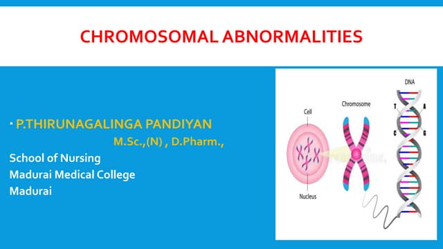 Edwards-Syndrome trisomy 18 presentation | PPTX