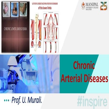 Chronic Arterial Diseases - Chronic Limb Ischemia | PDF