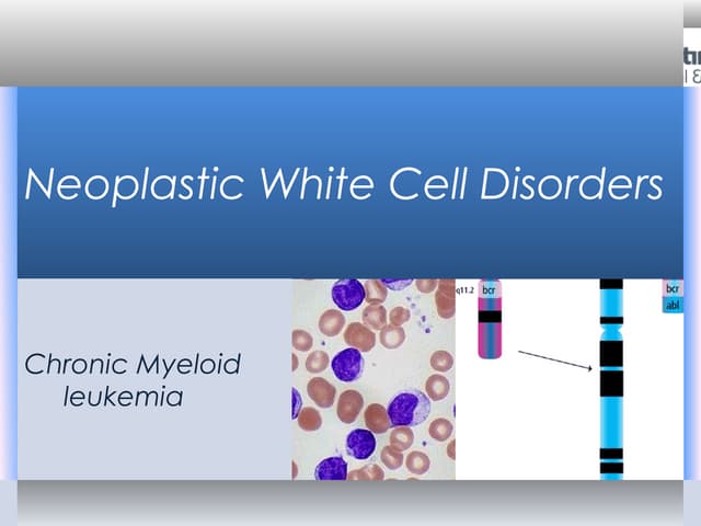 Chronic Myeloid Leukemia | PPTX