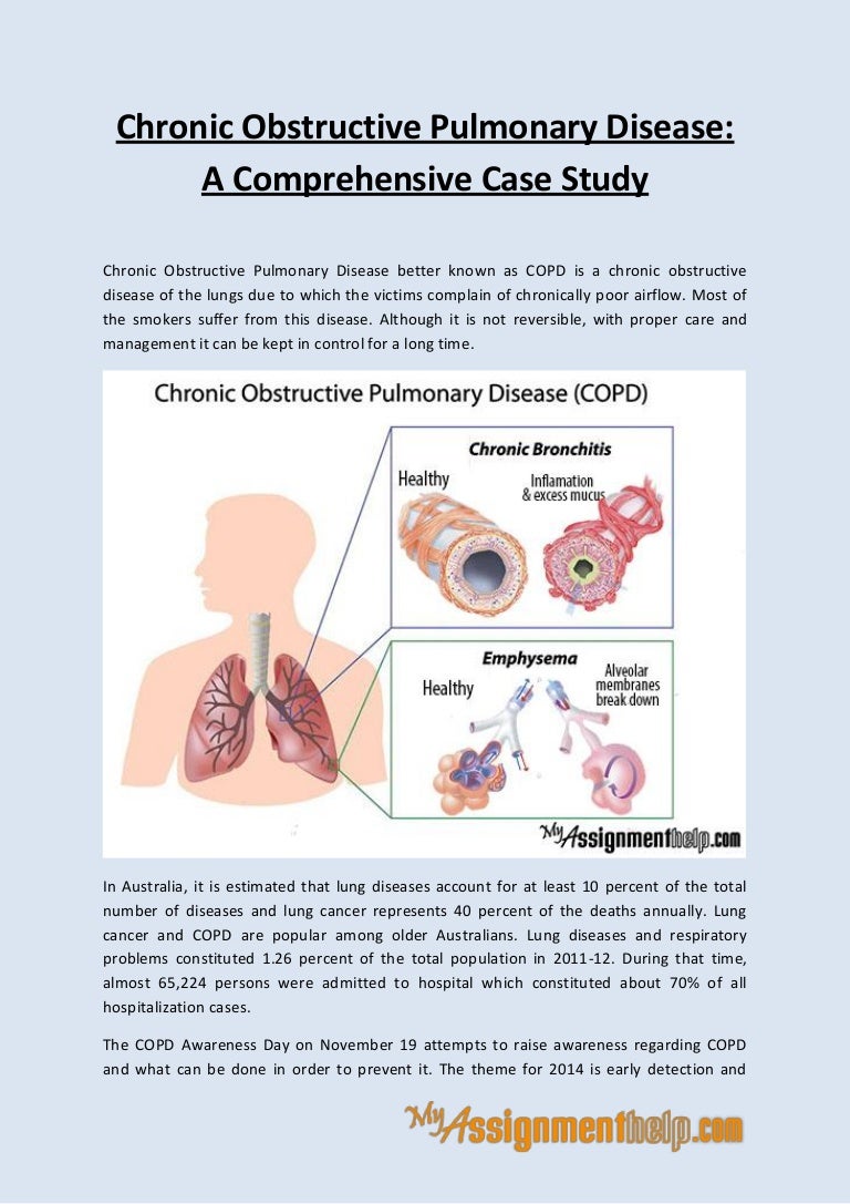 Chronic obstructive pulmonary disease a comprehensive case study