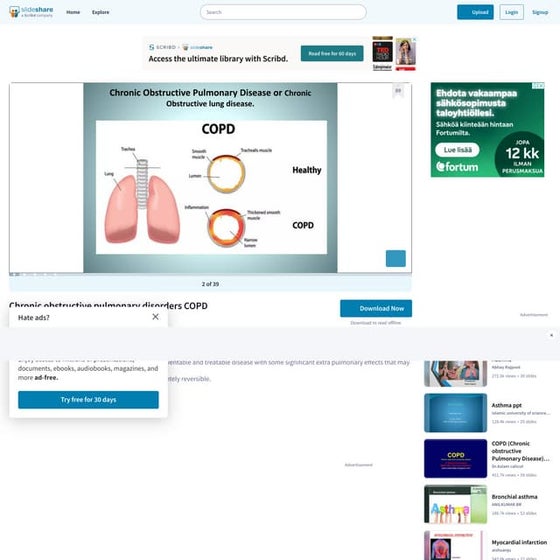 COPD(chronic obstructive pulmonary disease) ppt slideshare | PPTX