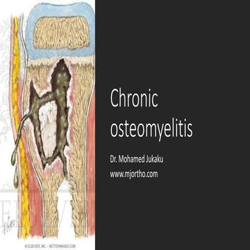 Chronic osteomyelitis | PPT