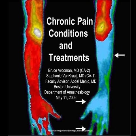 Chronic pain 1__1_[1] | PPT | Physical Therapy | Wellness