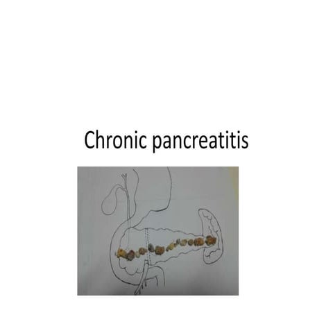 Chronic pancreatitis | PPTX