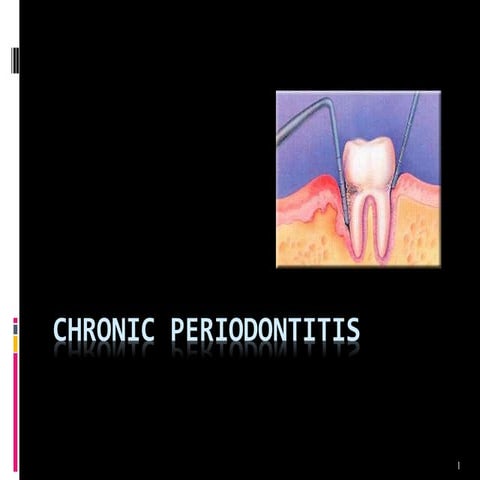 Chronic periodontitis presentation clinical | PPT