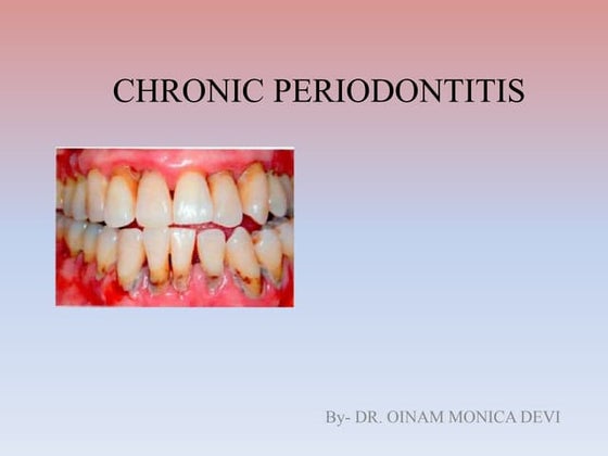 2017 classification of periodontal and periimplant diseases | PPTX