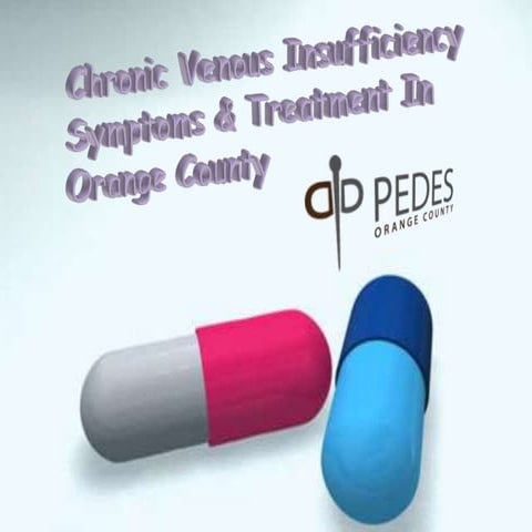 Chronic Venous Insufficiency Symptoms And Treatment | PPT