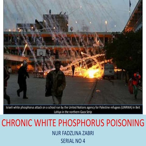 Chronic white phosphorus poisoning | PPTX